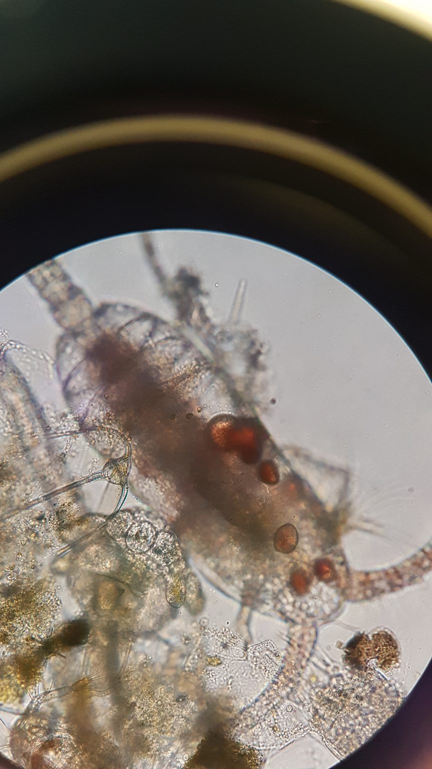 Under microscope – Copepod with parasites – Brittany Ferries